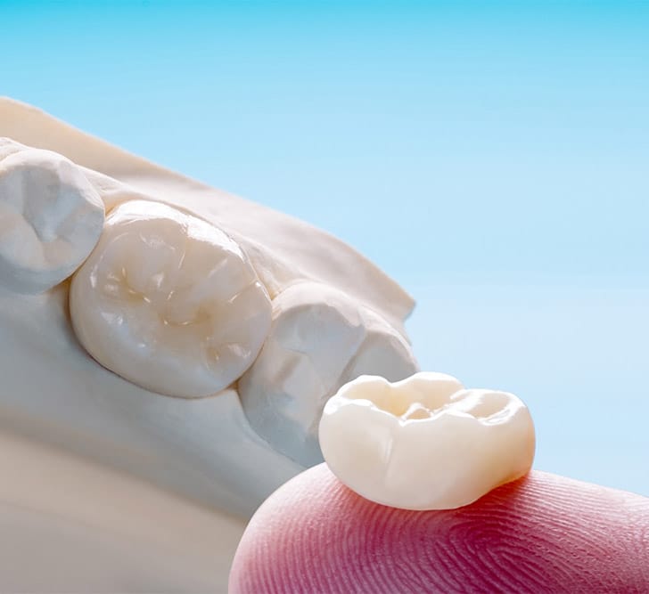 Traditional Crowns in Valley Stream, NY